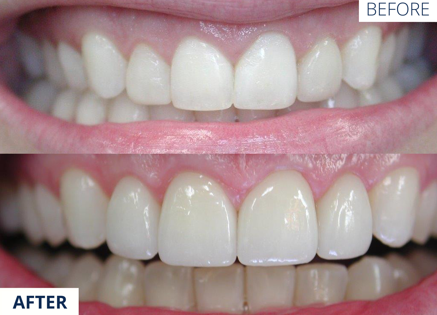 Smile Makeover Case - Toronto Dental Lab | Dental Laboratory | Dental ...